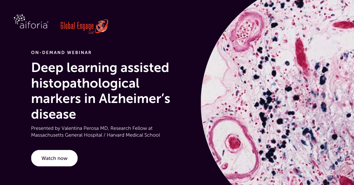 Webinar | Deep learning assisted histopathological markers in Alzheimer's disease